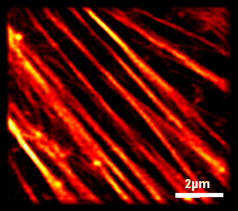 Discover LiveCodim a super-resolution platform • Telight