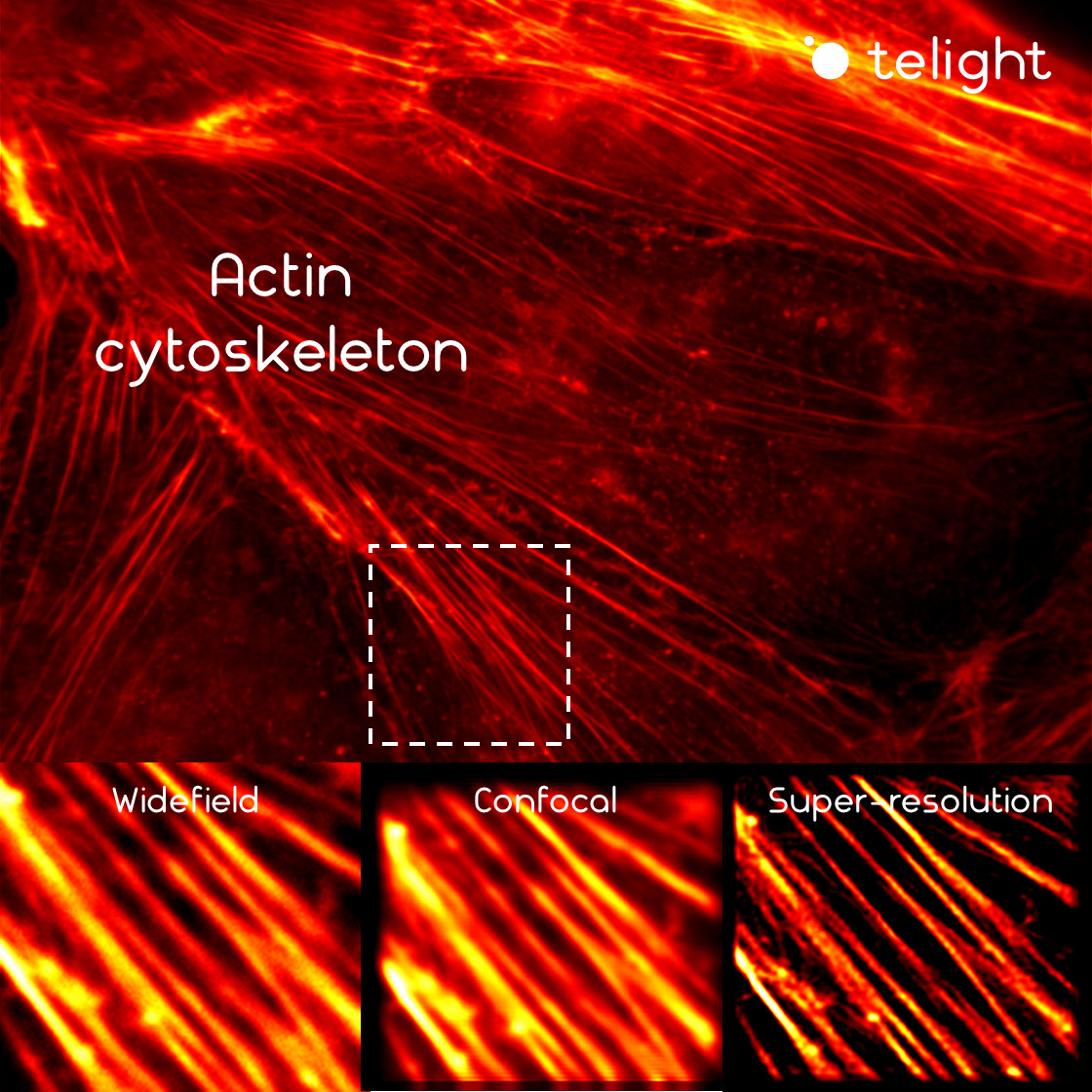 Telight solutions for Cancer research